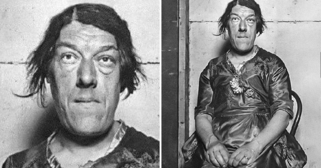 Najškaredšia žena na svete: V dospelosti sa jej zrazu znetvorila tvár ...