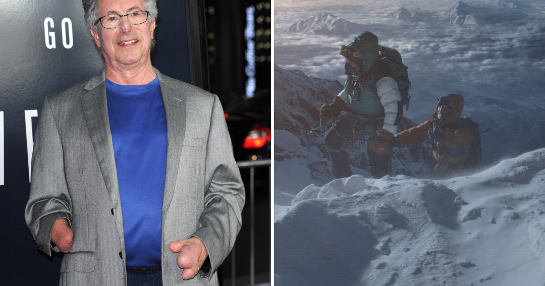 Odpadol mu nos, amputovali mu ruku a prsty: Beck Weathers prežil noc na ...