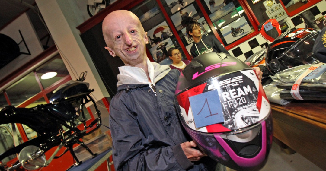 Vo veku 28 rokov zomrel Sammy Basso, najdlhšie žijúci človek s ...